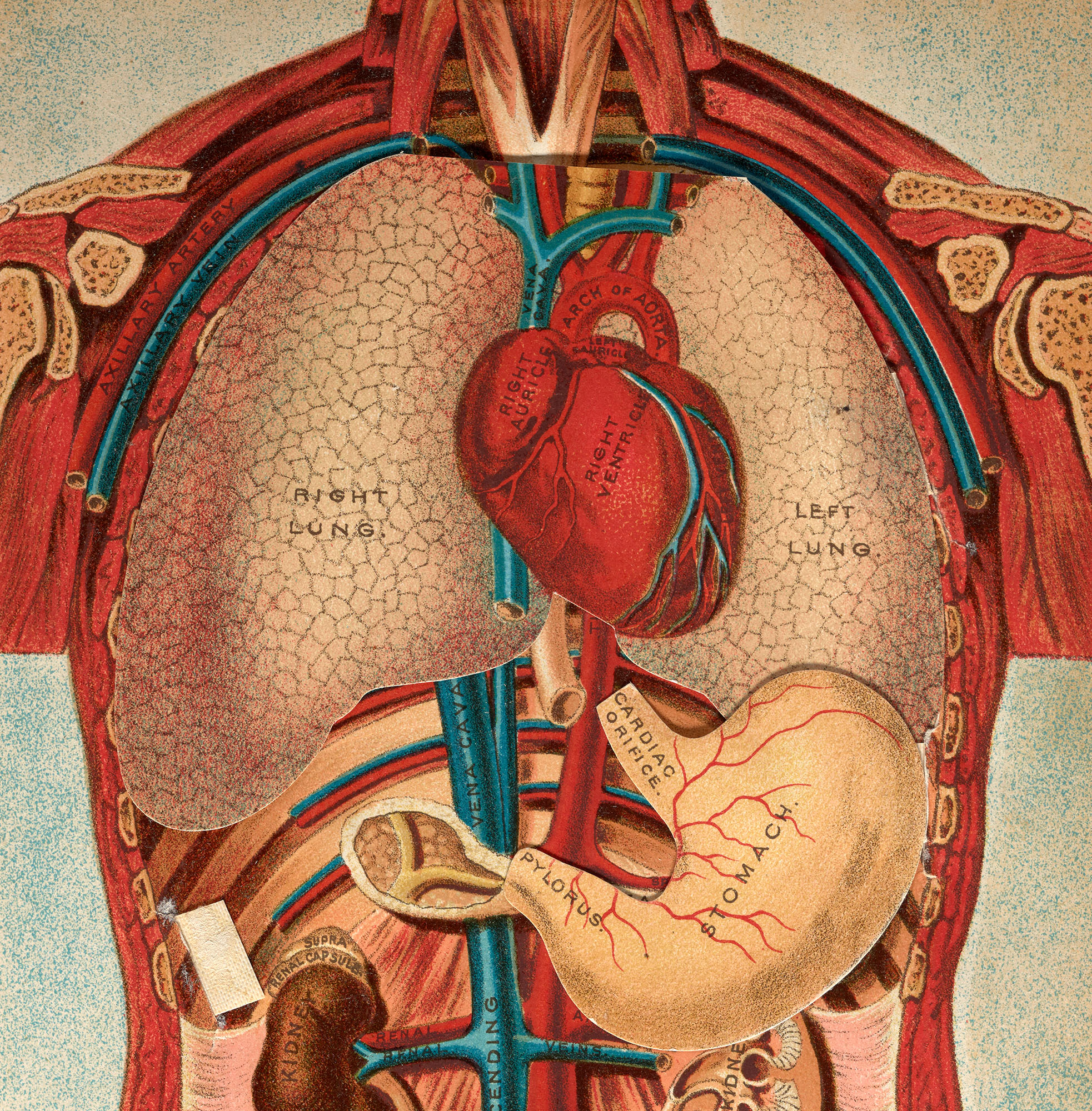 A Fix for the Unfixable: Making the First Heart-Lung Machine | Science ...