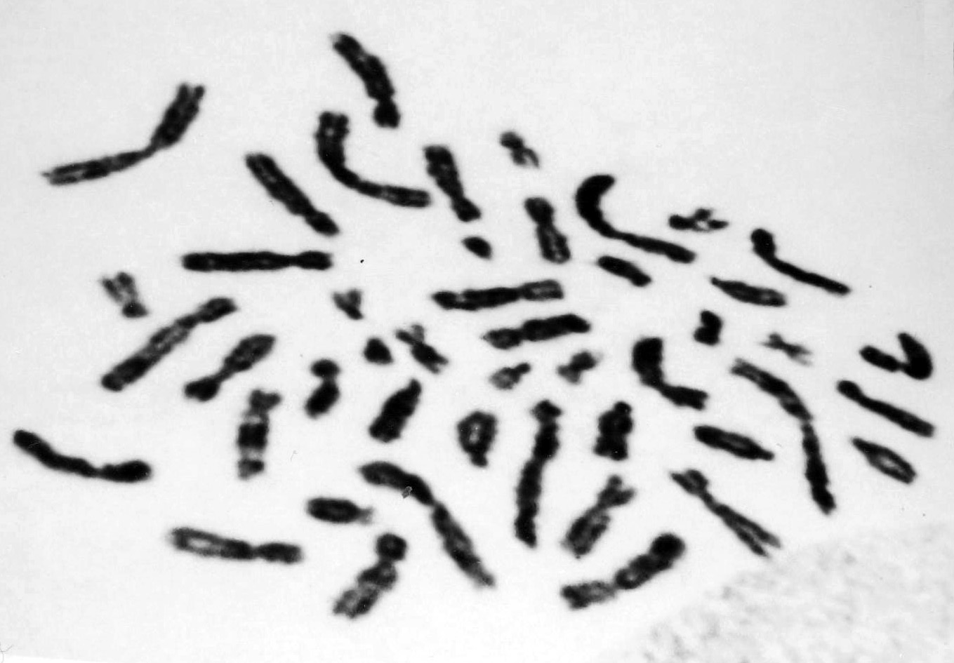 Joe Hin Tjio Counts Chromosomes | Science History Institute