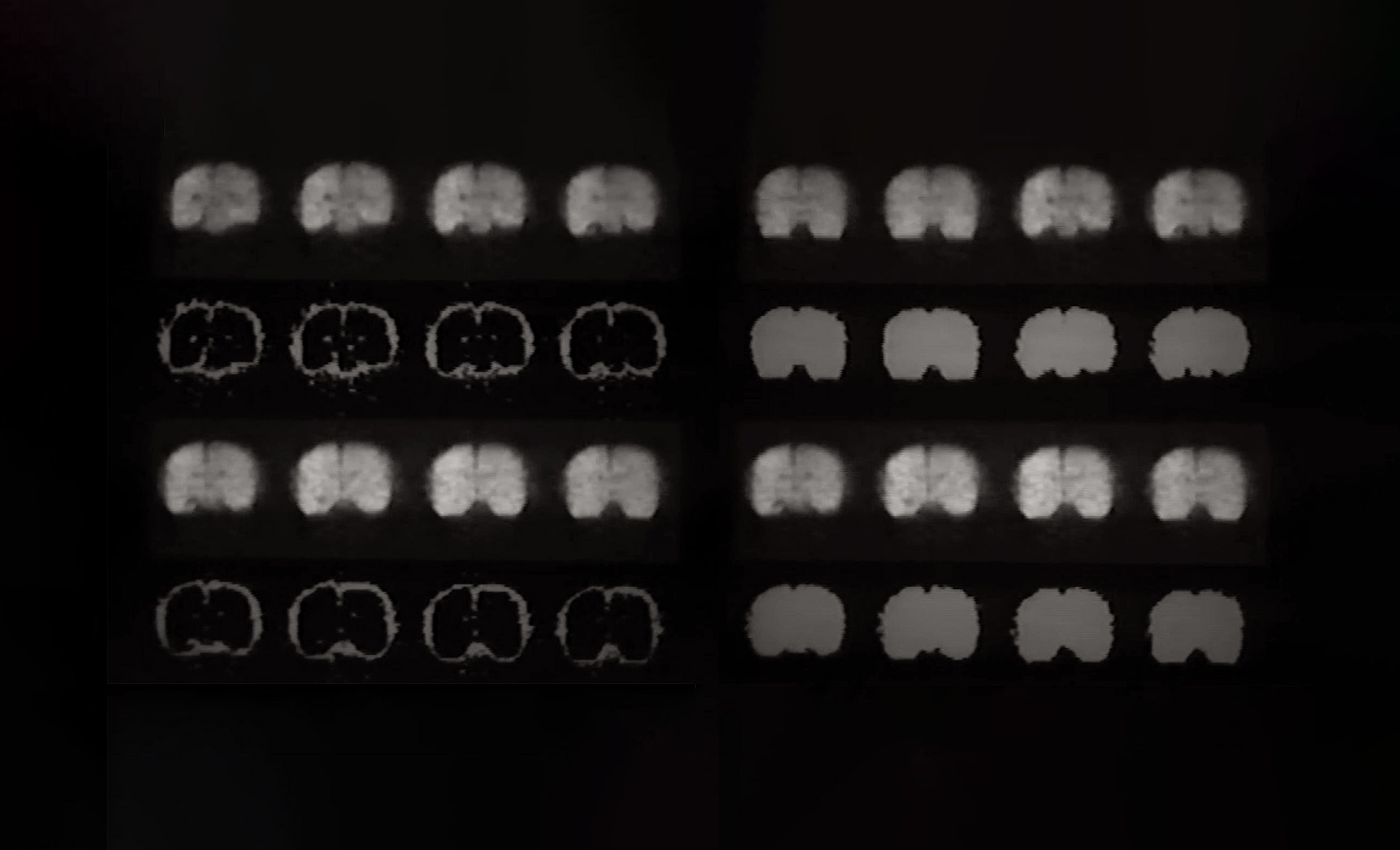 A Gray Matter | Science History Institute